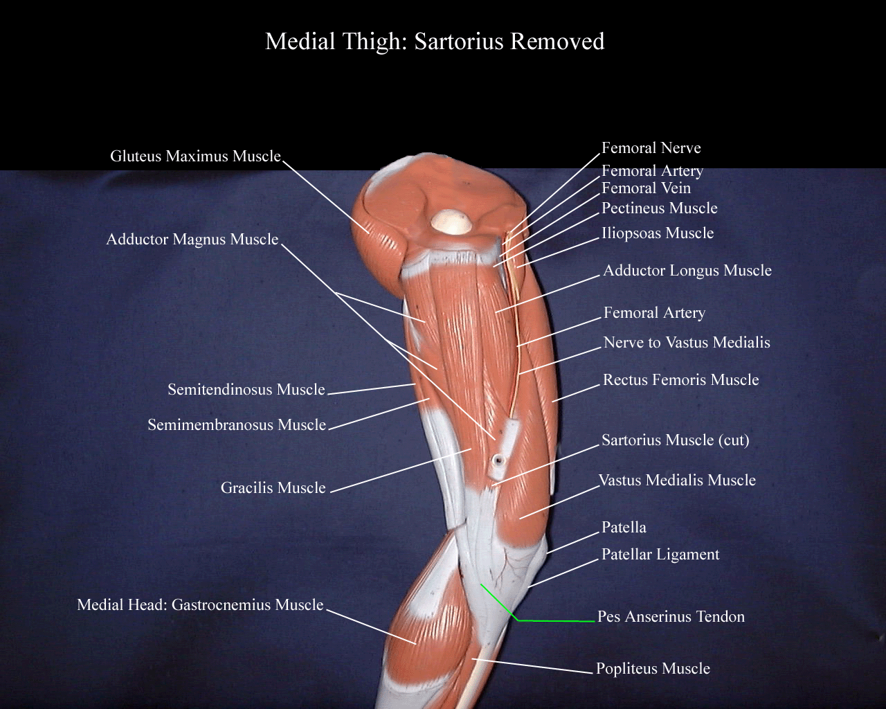 Medialthighadductorcanal Medialthighadductorcanal