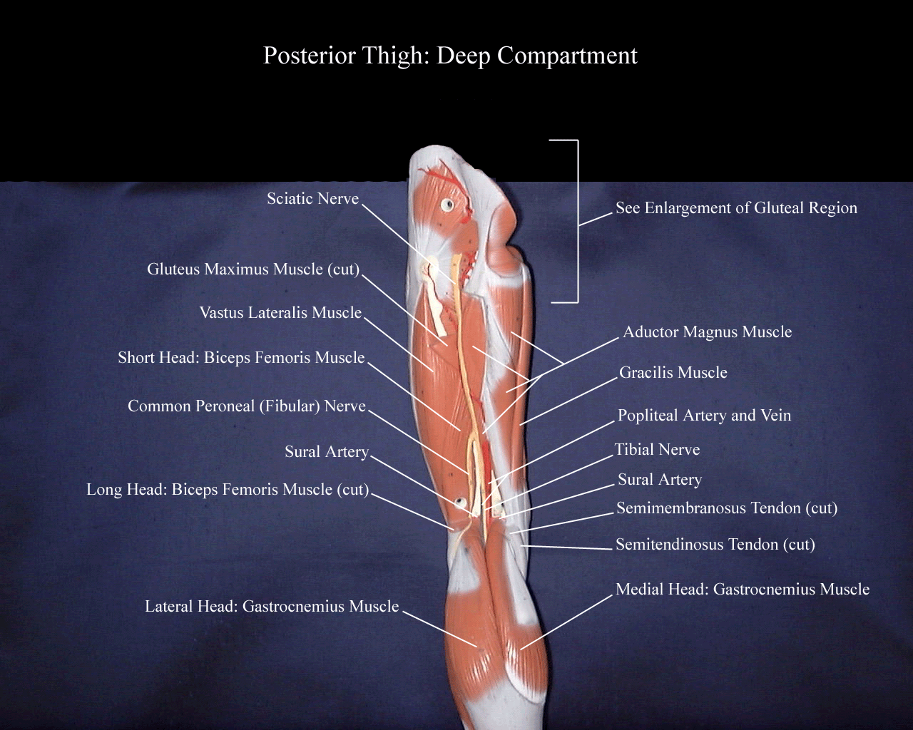 Posteriorthighmodeldeep Posteriorthighmodeldeep